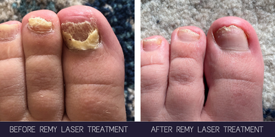 Lower Extremities - RemyFX